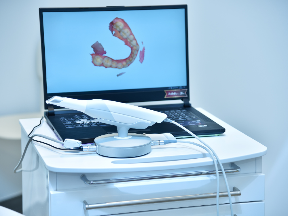 Intraoral Photography - East Indy Dental Care - Indianapolis